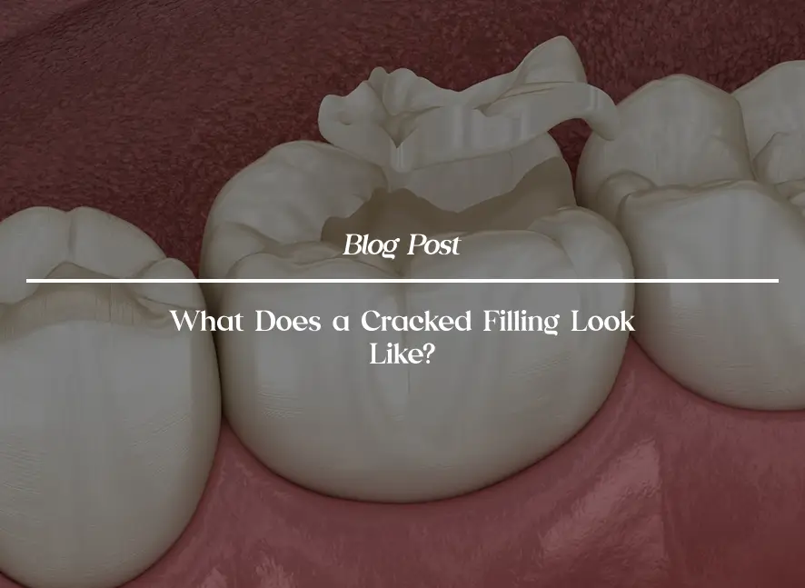 What Does a Cracked Filling Look Like?